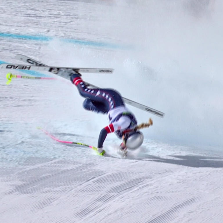 Lindsey Vonn’s gory update after latest post-Olympic crash surgery ...