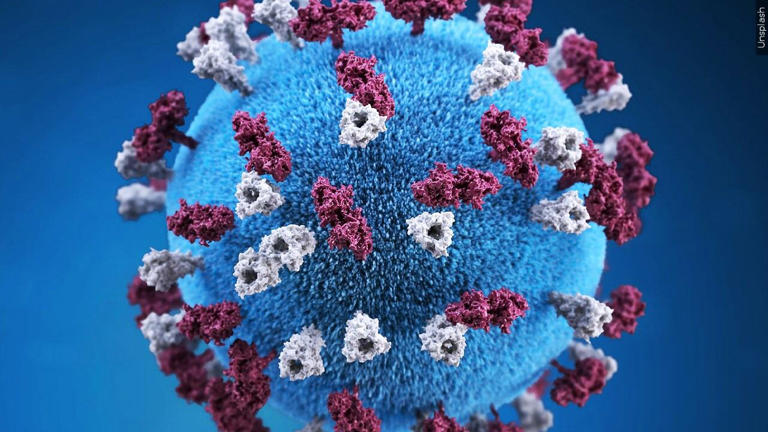 Measles spreads to Walsh County as ND outbreak expands