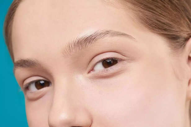 Why your dark spots aren’t fading and what finally works