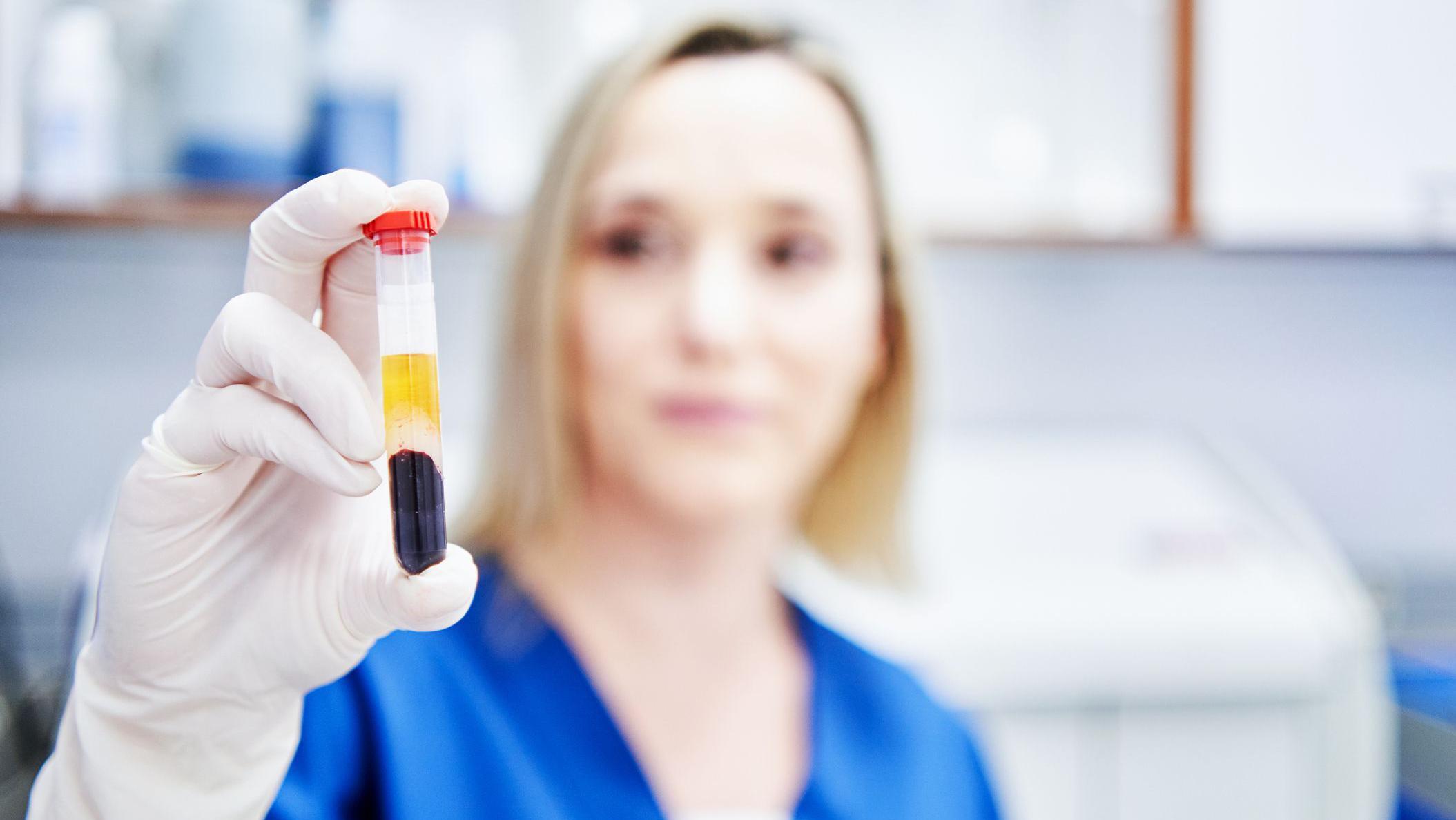 Multi-cancer blood test missed key goal in NHS trial