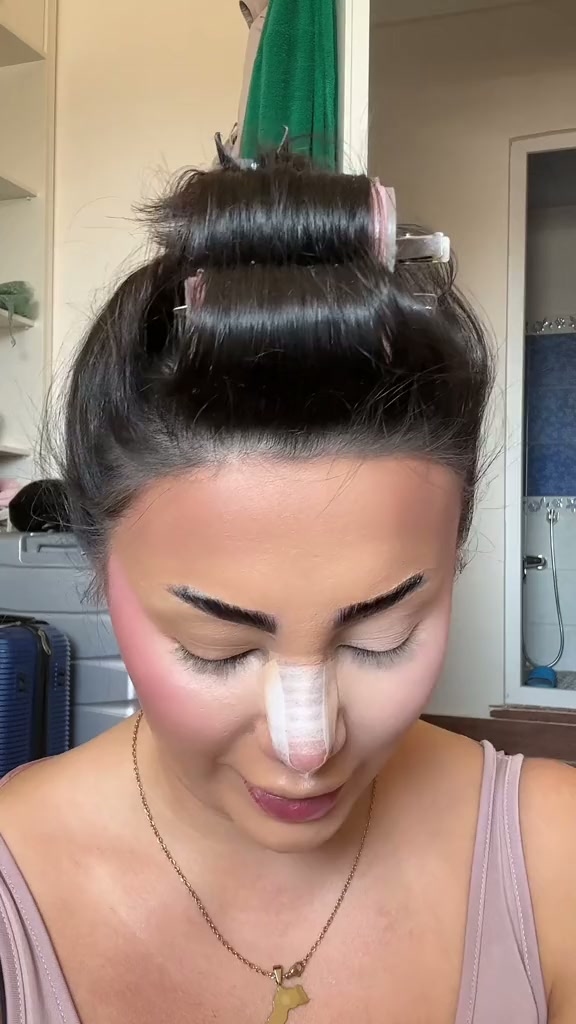 Inside my Tehran revision nose job and recovery routine