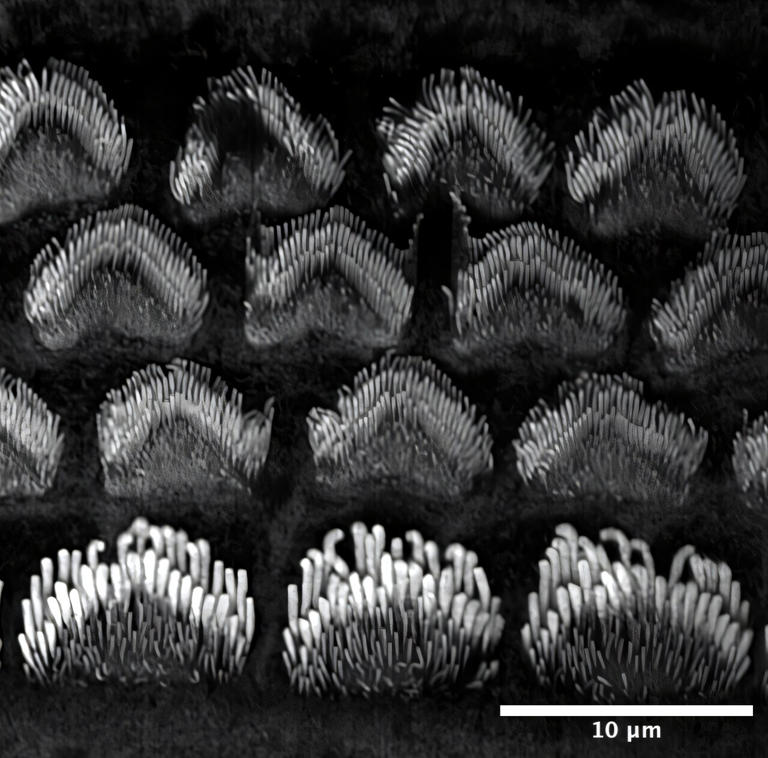 A hidden reason inner ear cells die—and what it means for preventing ...