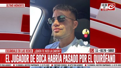 Jugador de Boca apareció con los labios operados y causó revuelo en las ...