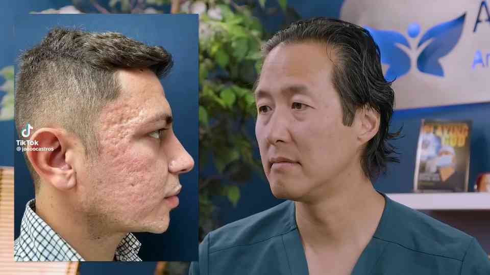 Plastic surgeon reacts to viral TikTok surgery trends