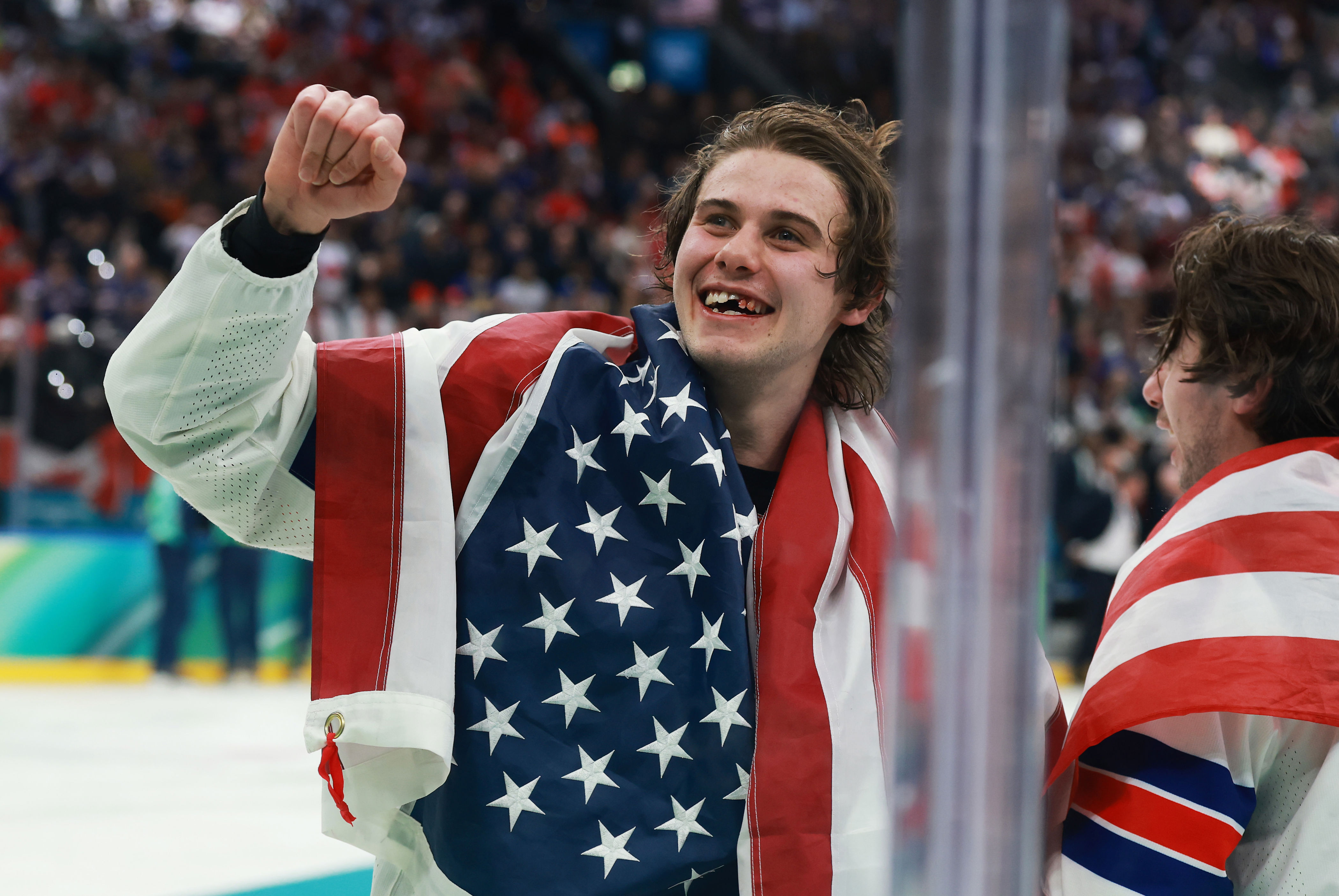 Jack Hughes loses some teeth, picks up gold in epic US win over Canada