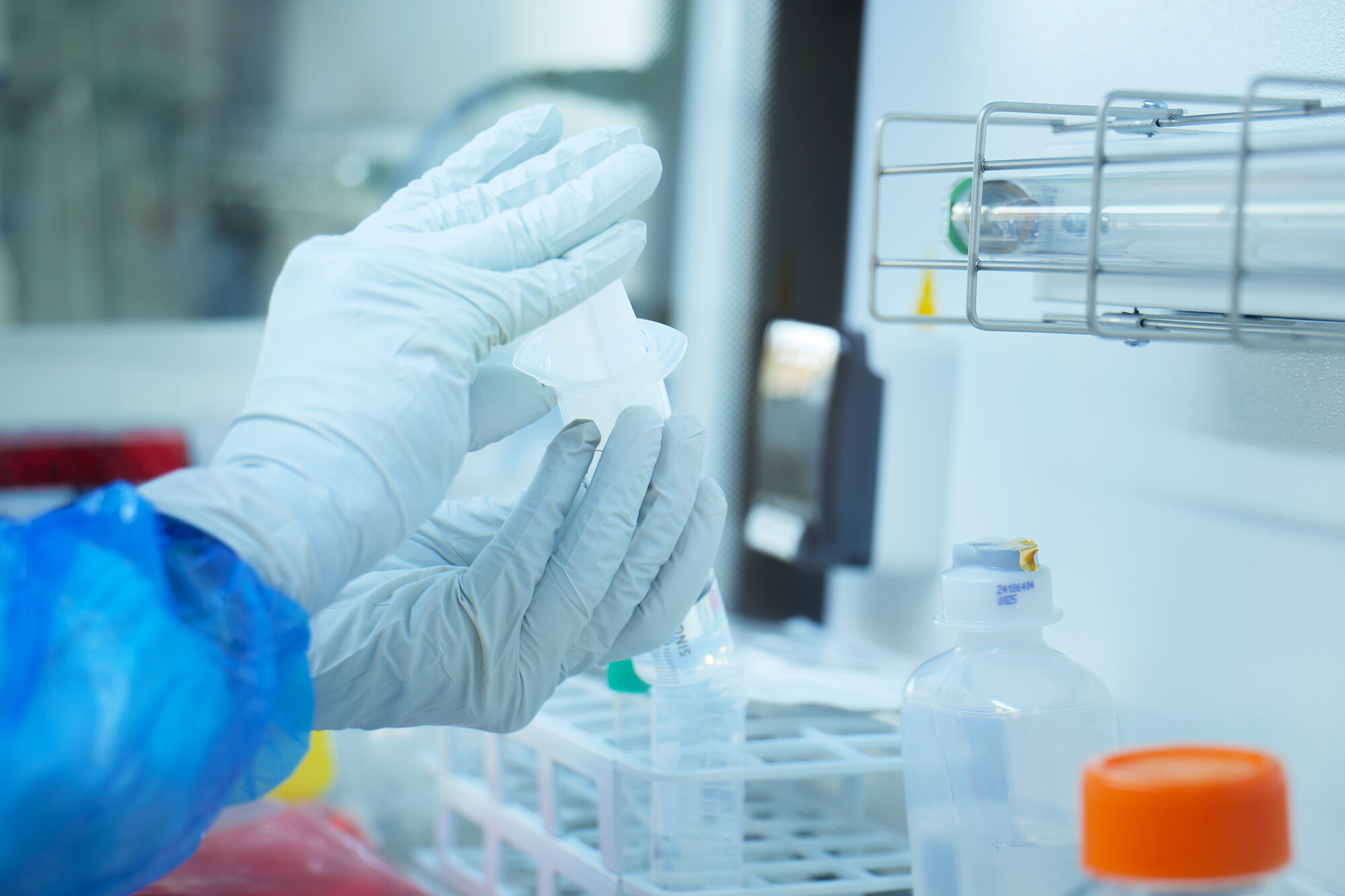 Leucemia infantile, ecco come cellule sopravvivono per anni