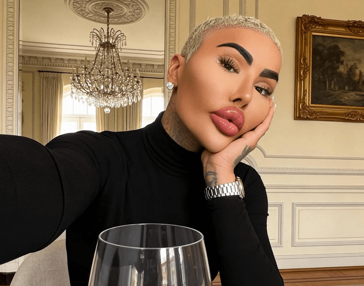 Who is Jordan James Parke? Family heartbroken as ‘Lip King’ influencer dies