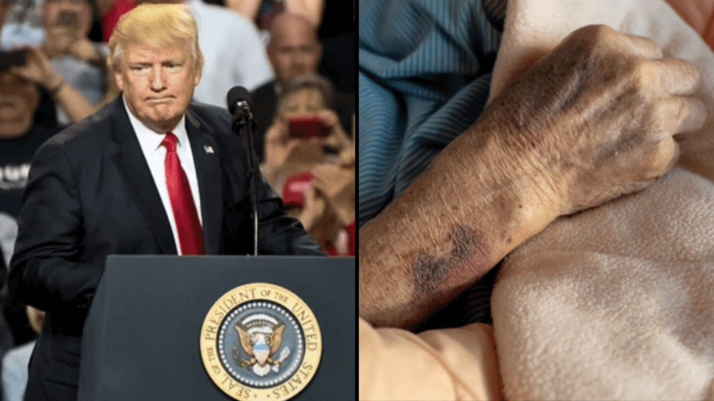 Doctor raises serious concern about Trump’s ‘shrinking frontal lobe’