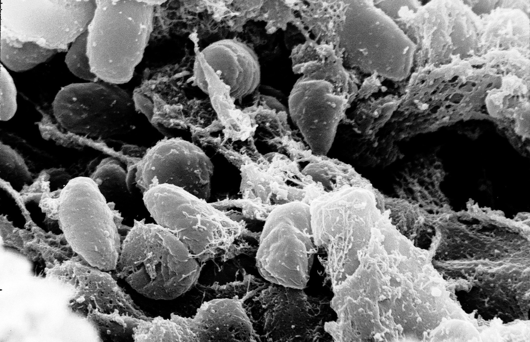 10 diseases that are extremely lethal