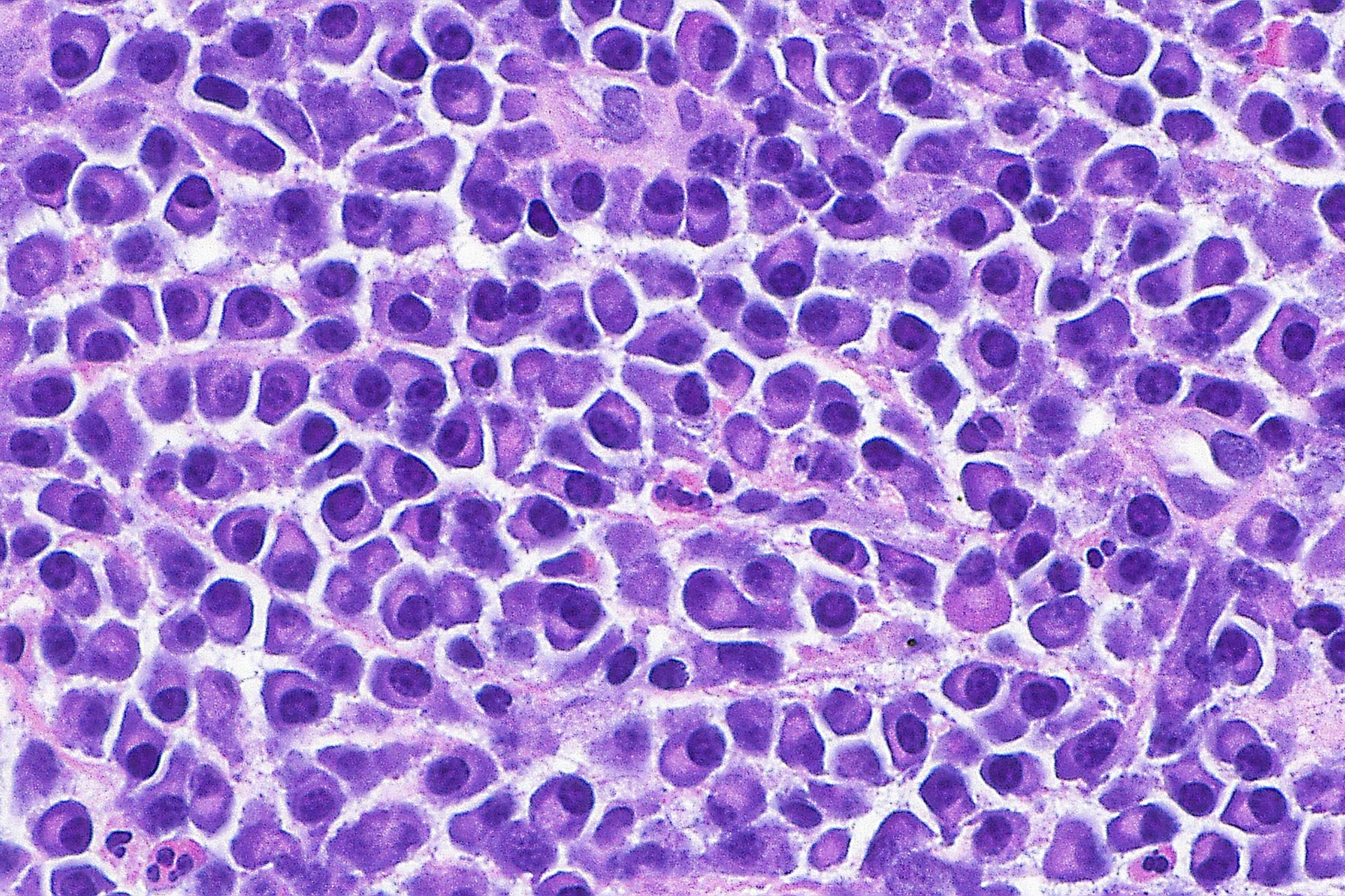 Millions of your mother's cells still live inside of you