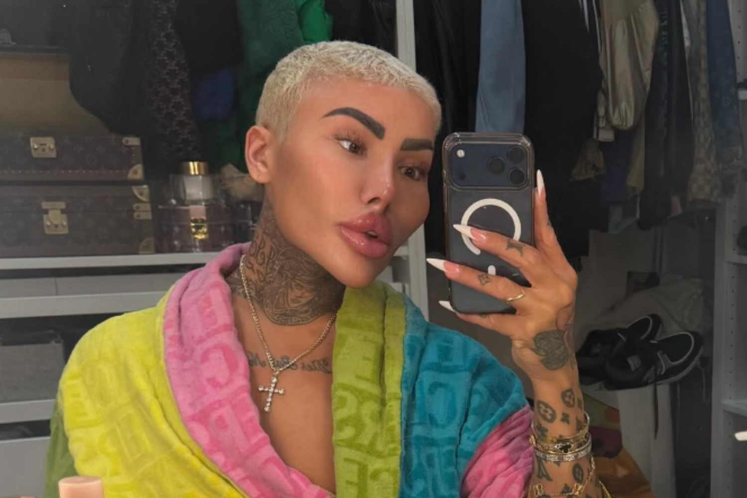 Jordan James Parke: Reality TV star dubbed 'The Lip King' dies after ...