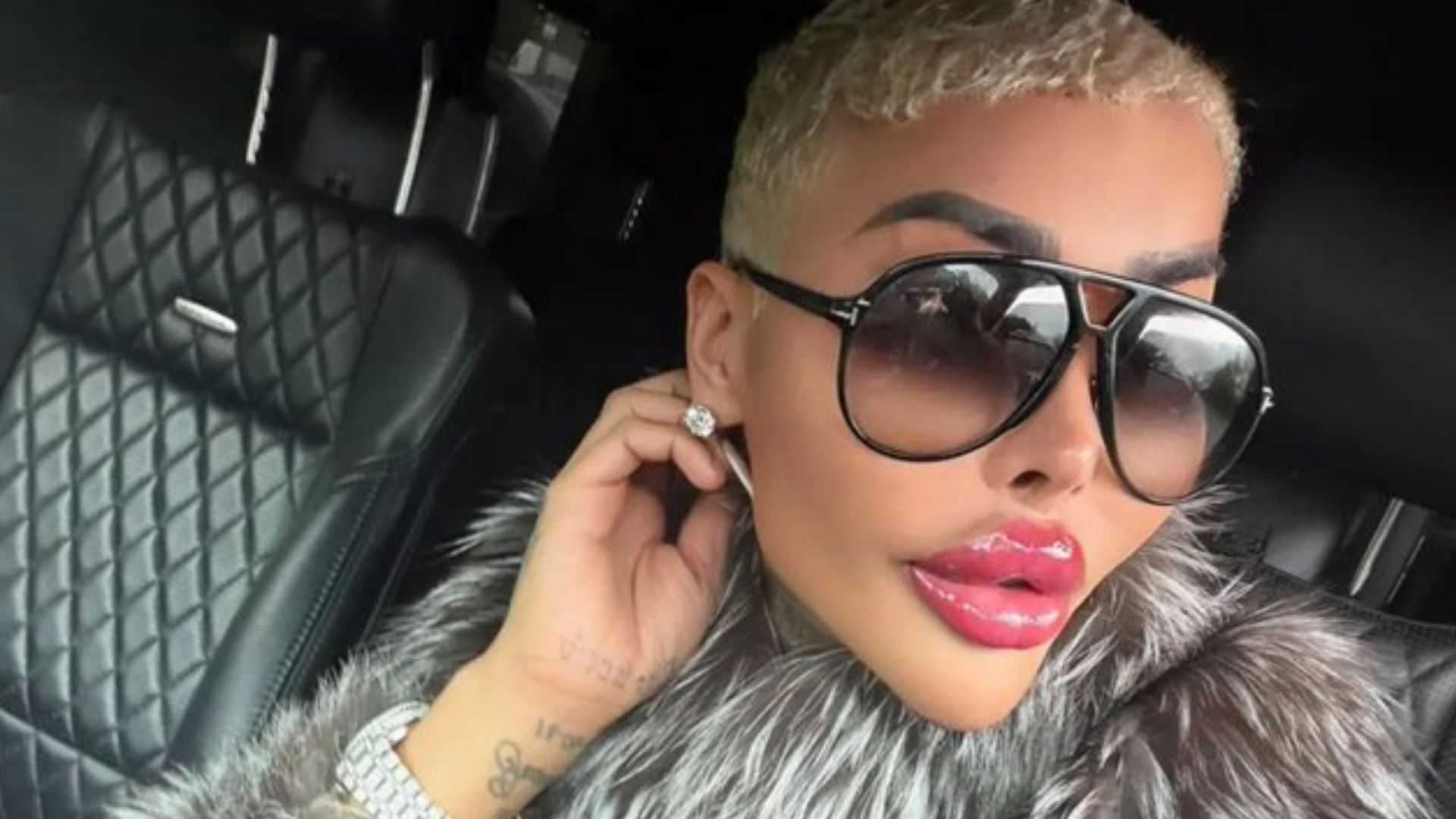 'Lip King' Jordan James Parke dead at 34 after possible cosmetic ...