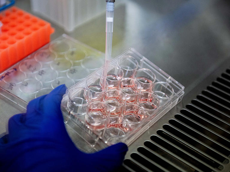 A hidden neuron 'gatekeeper' may shape Alzheimer's buildup of amyloid-beta
