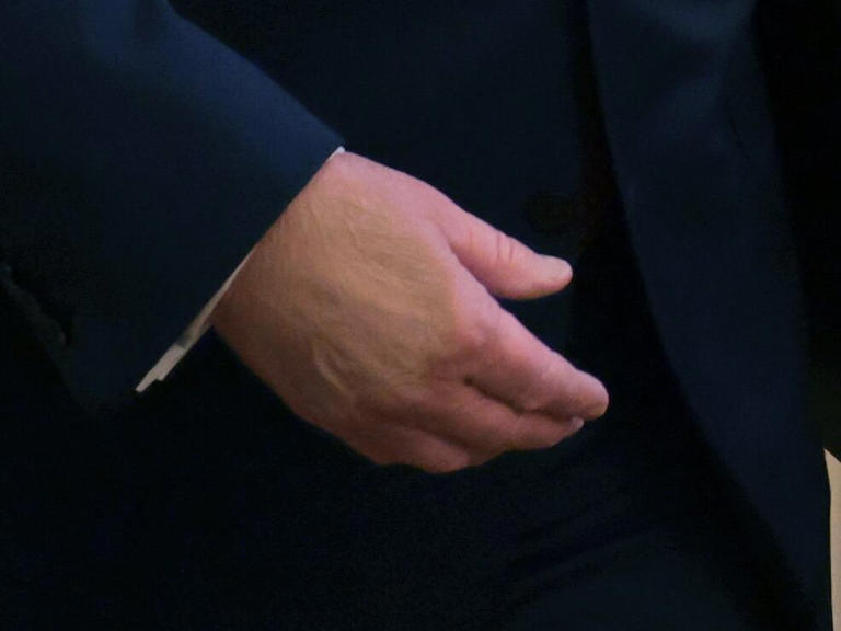 Trump, 79, smears makeup on decaying hand