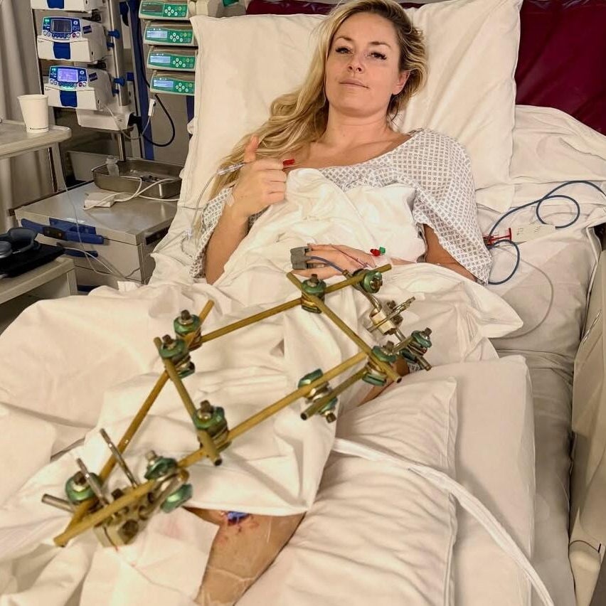 Lindsey Vonn shares update after 3rd surgery: "I'm making progress"
