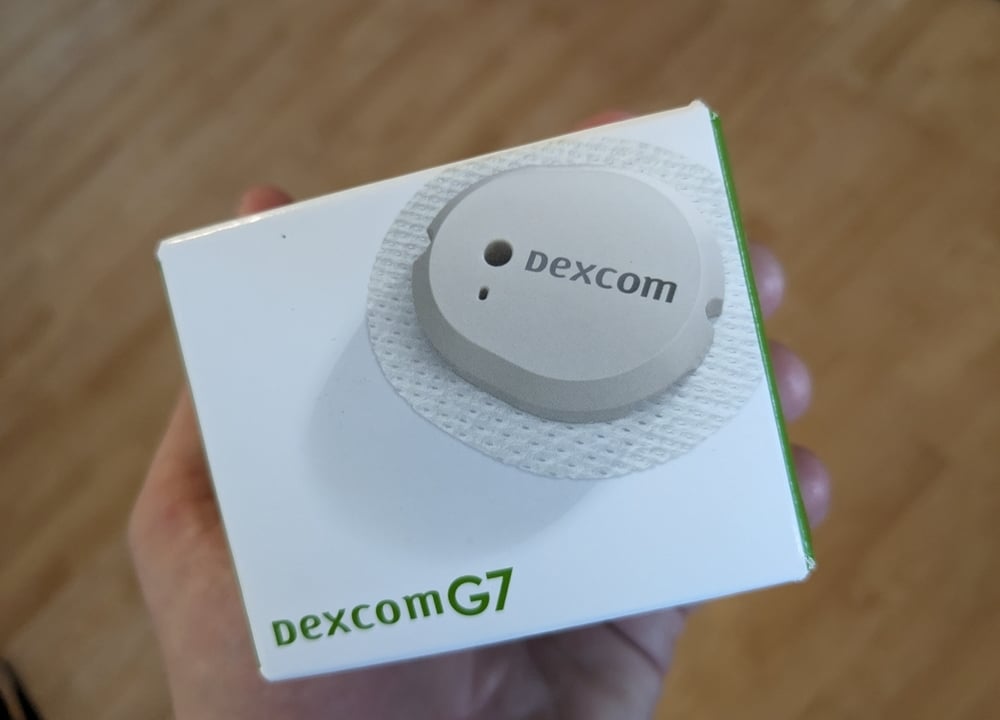 Dexcom reports better-than-expected Q4 results: Details