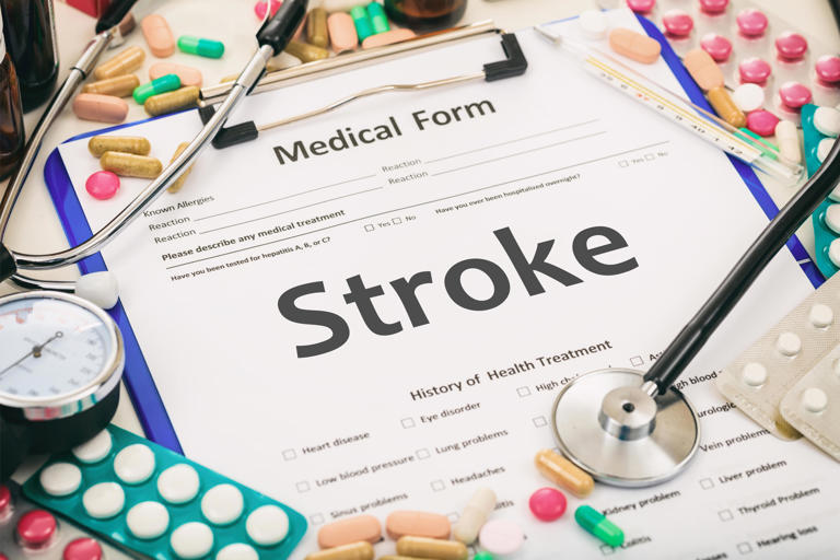 4 subtle stroke warning signs that should never be ignored