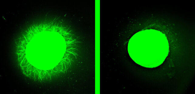 Scientists grew mini human spinal cords, then made them repair after injury