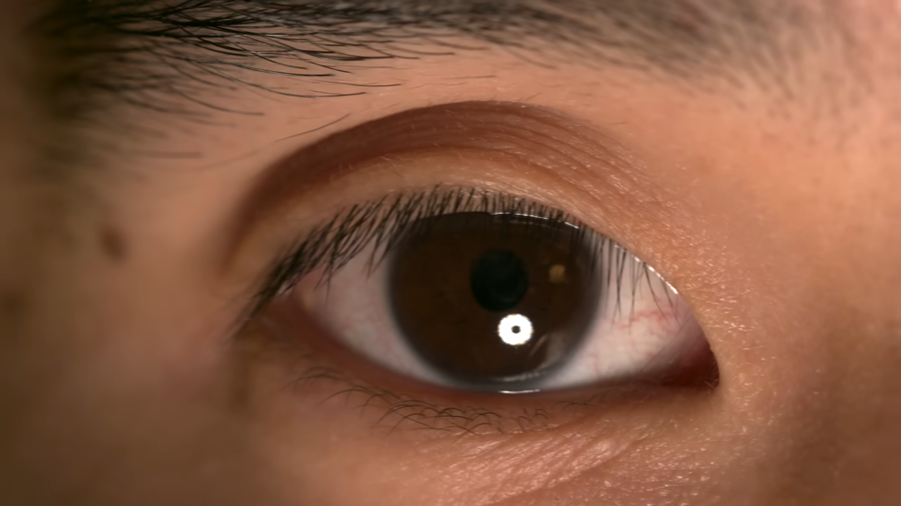 This is what 10 years of junk food did to his eyesight