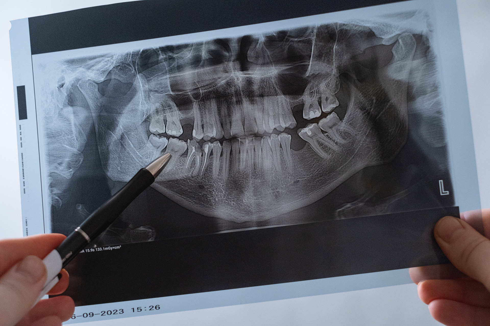 What your mouth says about your health