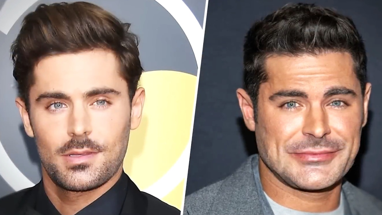 Zac Efron shocked fans with his new face - what actually happened?