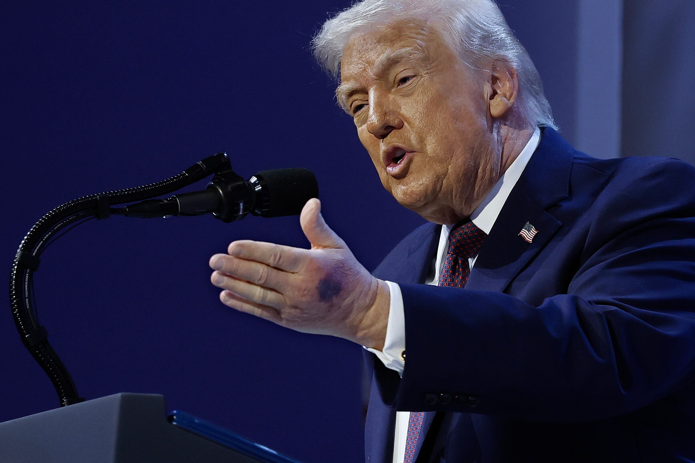 Carville questions findings in Trump’s latest physical report