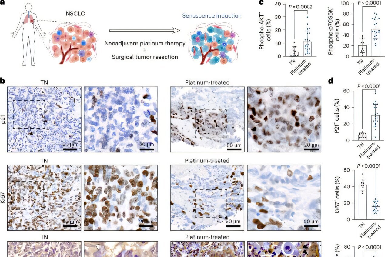 The 'zombie cell' effect: New study explains chemotherapy resistance in ...