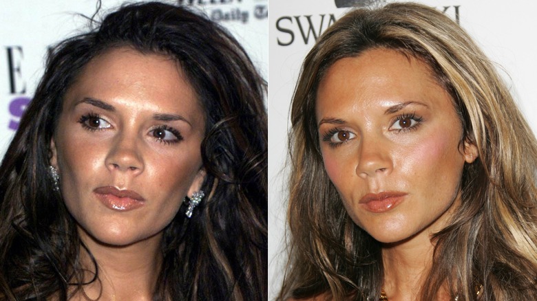 Victoria Beckham's stunning face transformation since her Spice Girls days