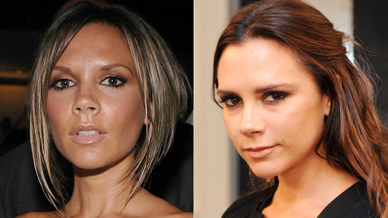 Victoria Beckham's stunning face transformation since her Spice Girls days