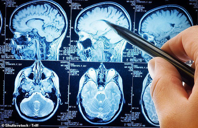 More than just tremors: Expert lists four early warning signs of ...