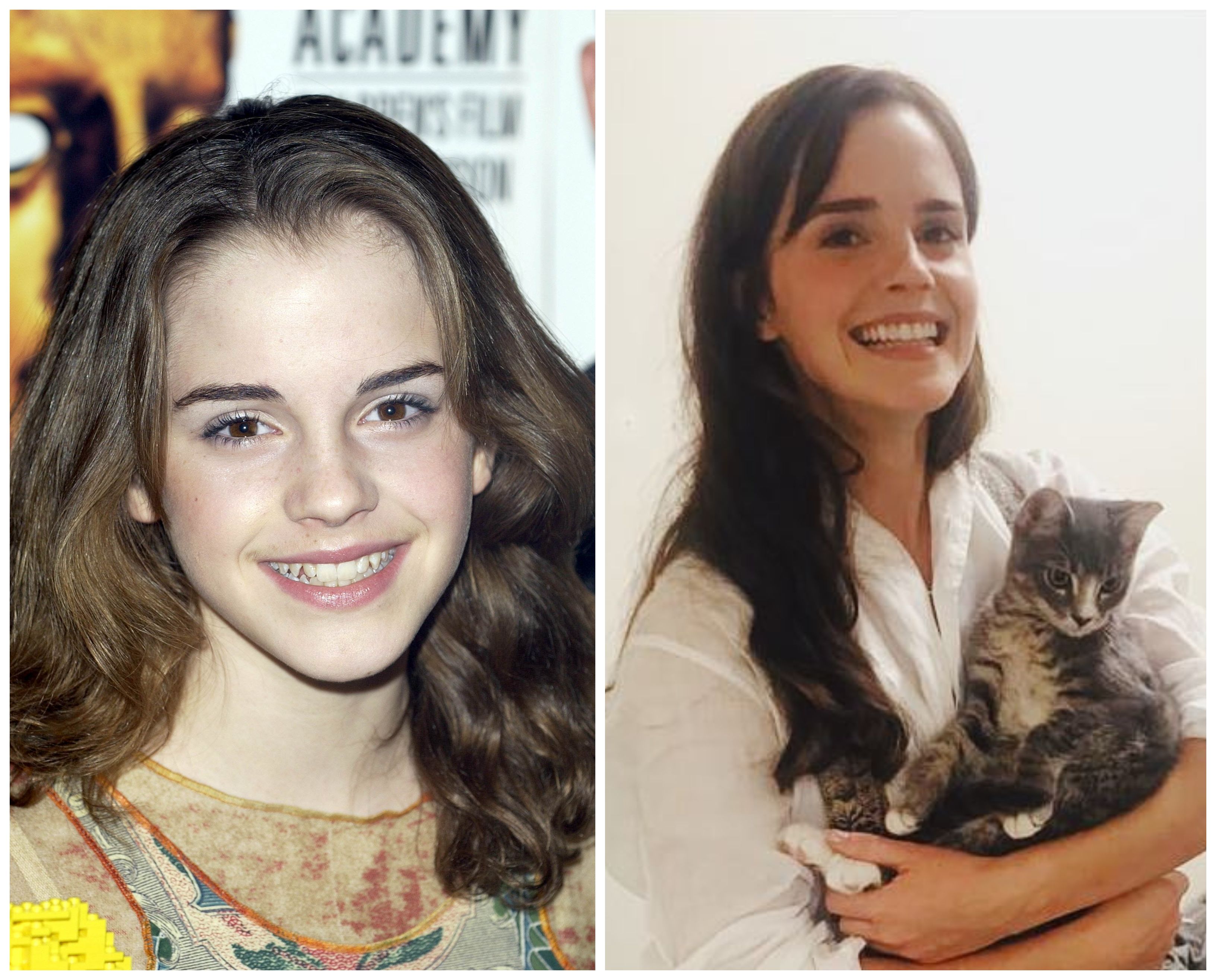 Celebrities who paid big for perfect smiles