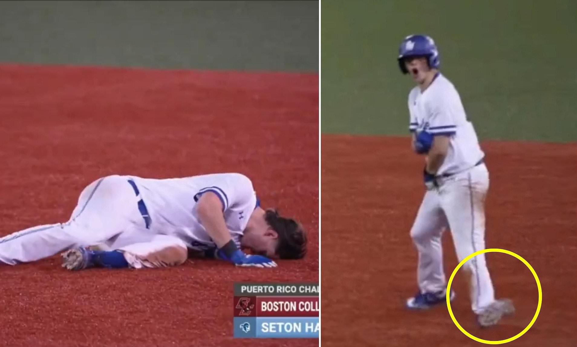 College baseball player suffers horrific leg injury in freak accident ...