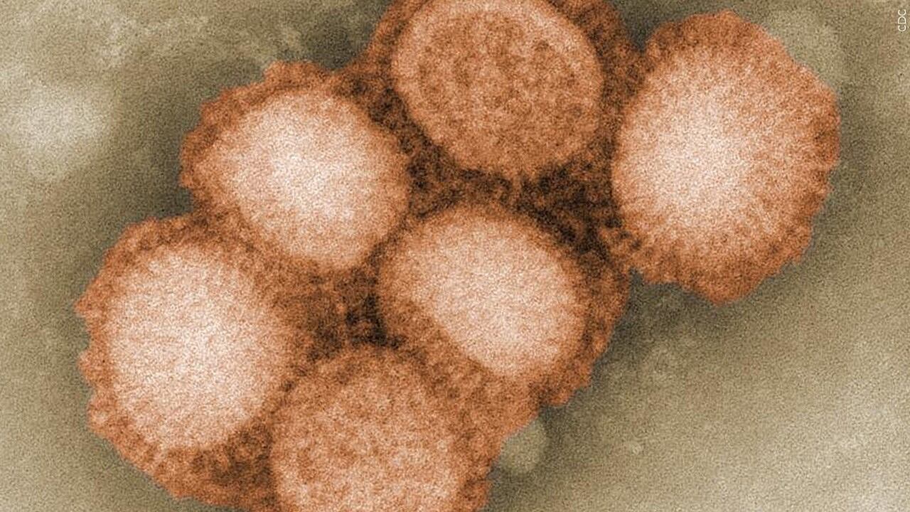 Deaths from flu continue to rise in Massachusetts