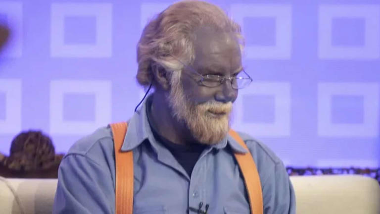 Paul Karason, the man who turned blue