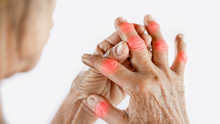 A journey from chronic arthritis to renewed hope through yogic healing