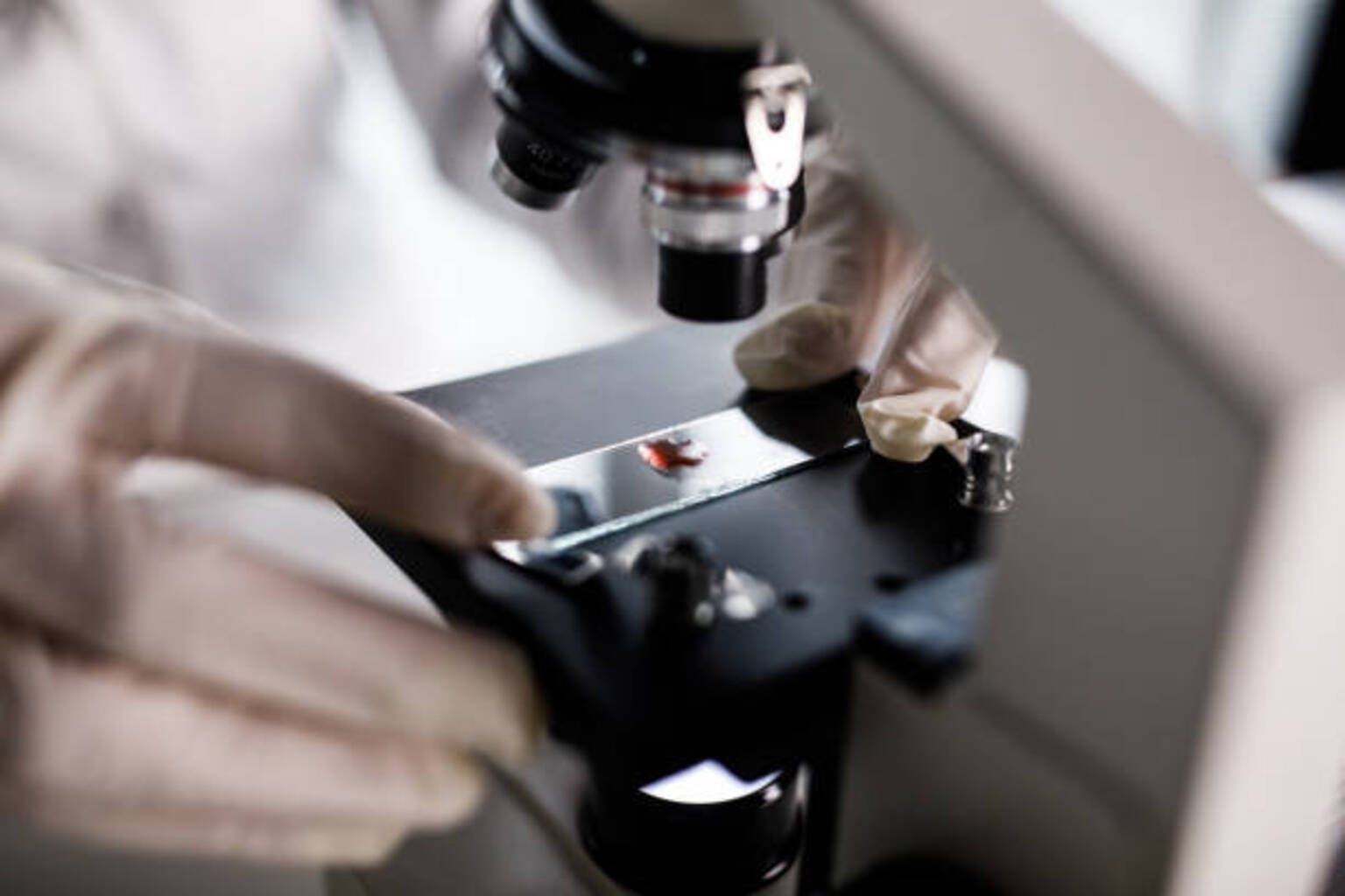 Teva, Sanofi report durable phase 2b efficacy for duvakitug in ...