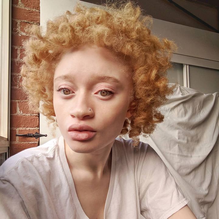 Instagram's Remarkable Faces: People Who Stop You Scrolling>