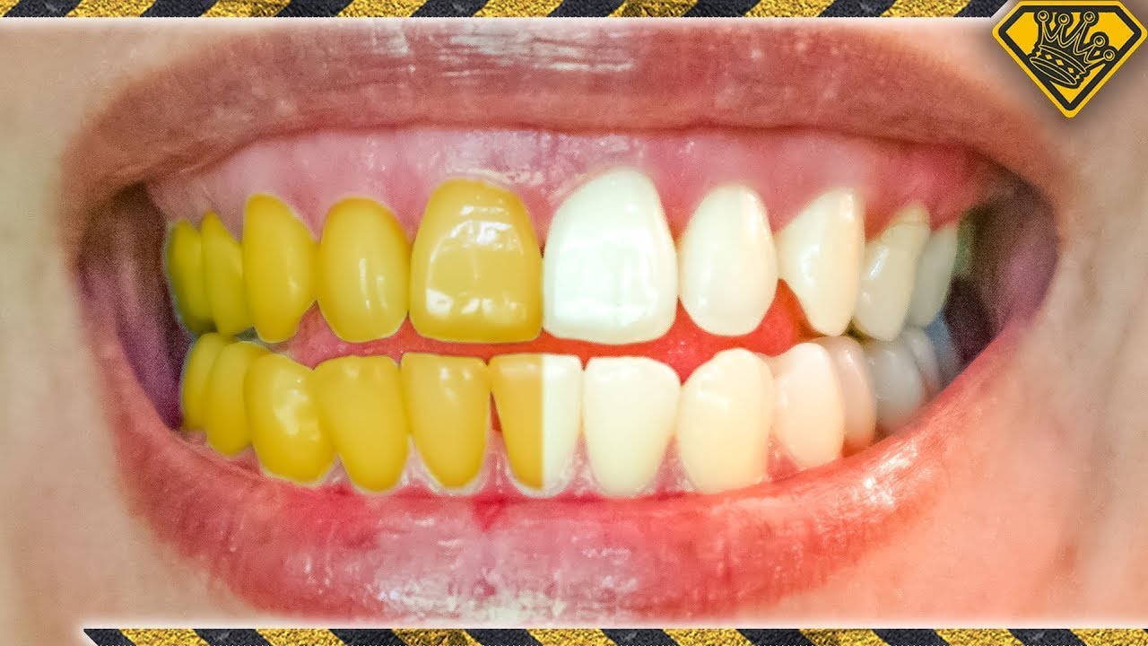 We tested which teeth whitening methods actually work