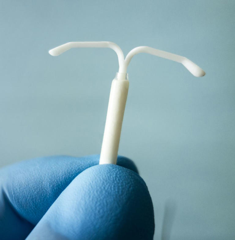 Do the benefits of an IUD outweigh the potential side effects?