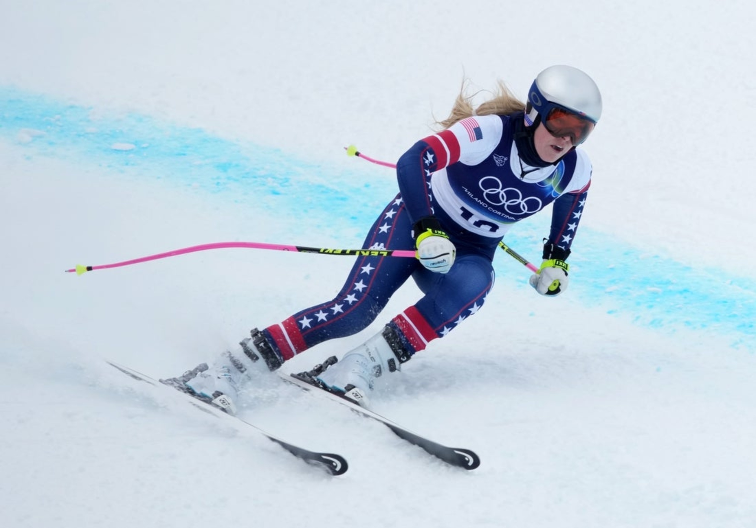 Lindsey Vonn has more surgery, hopes to go home soon