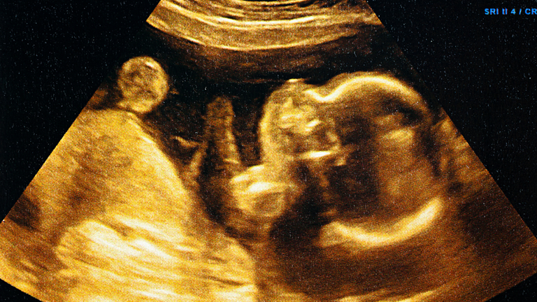 When and how baby’s eyelashes and eyebrows begin to form