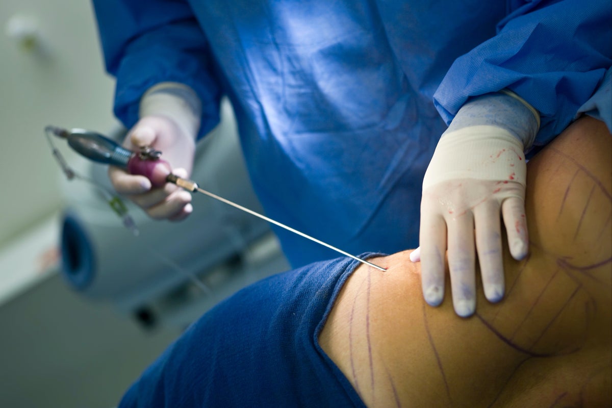 MPs call for an immediate ban on this cosmetic surgery