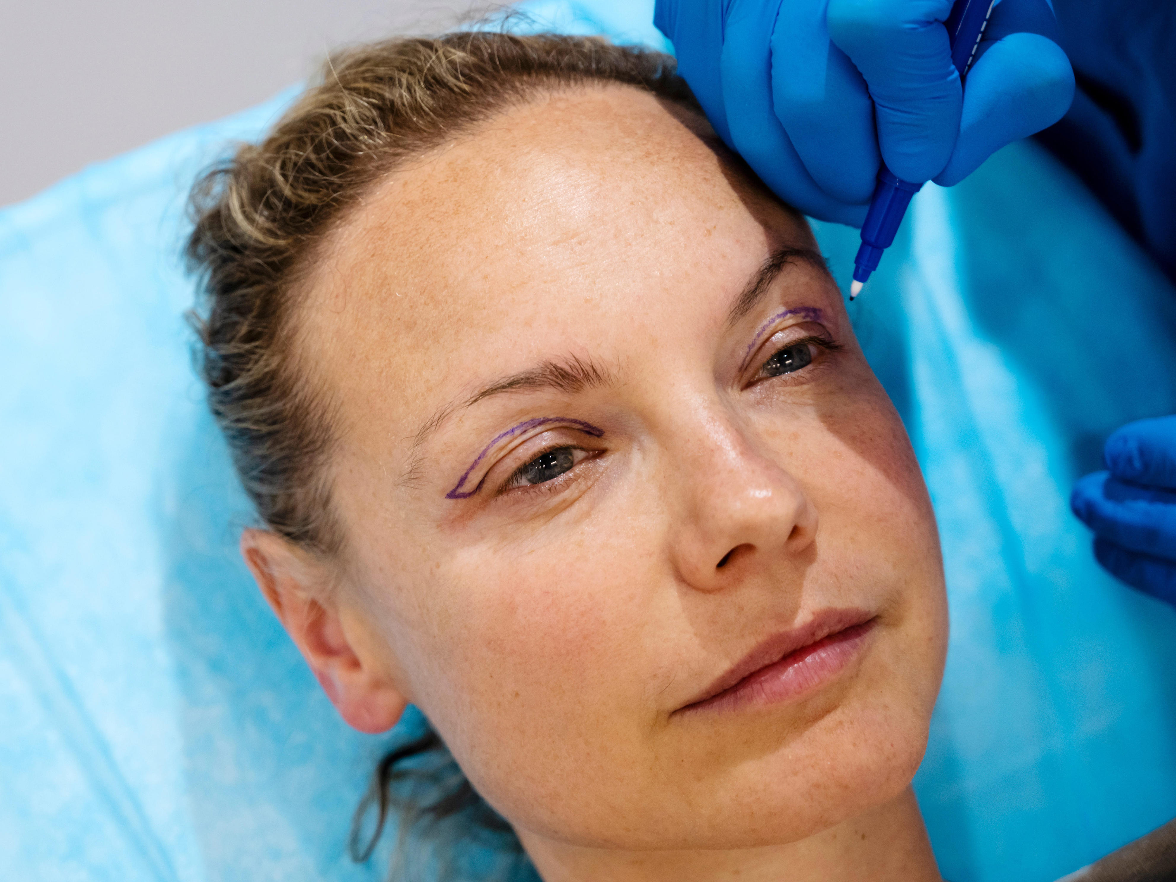 A plastic surgeon said nearly half his work is revisions. The most ...