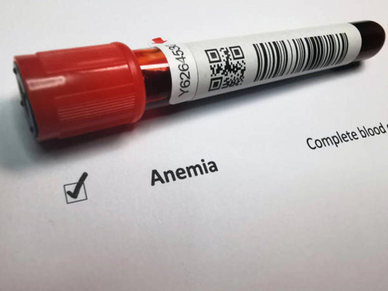 J&J seeks additional indication for Imaavy for rare type of anemia
