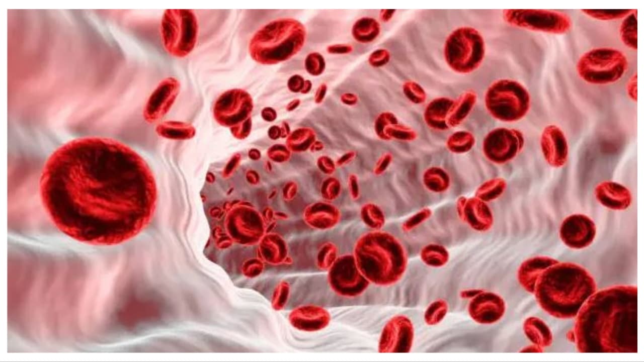 Low haemoglobin? 5 foods that can naturally boost your blood count
