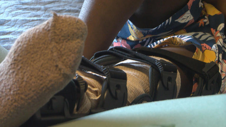 SGA mother demands answers after student suffers severe leg injury at ...