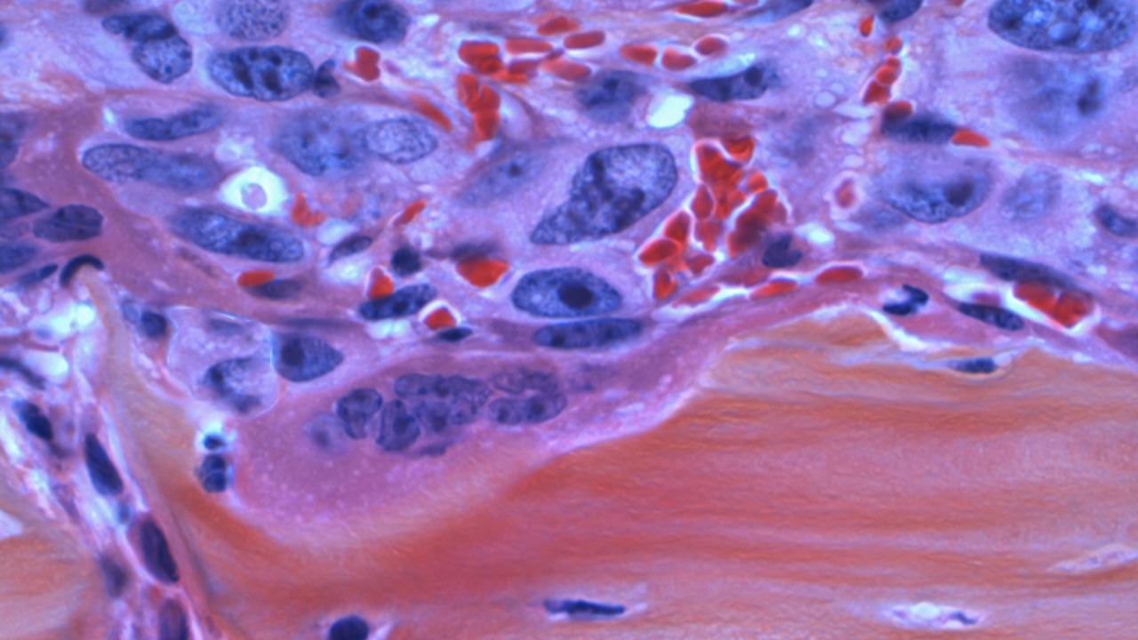 Cellular droplet structure study points to new drug targets for cancer