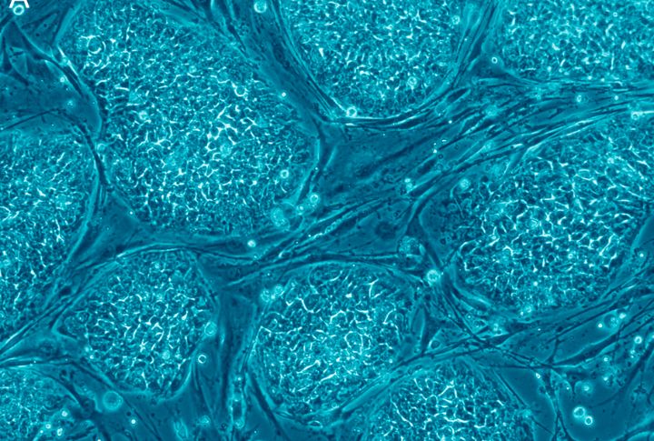 20 advancements that could push the boundaries of the human lifespan