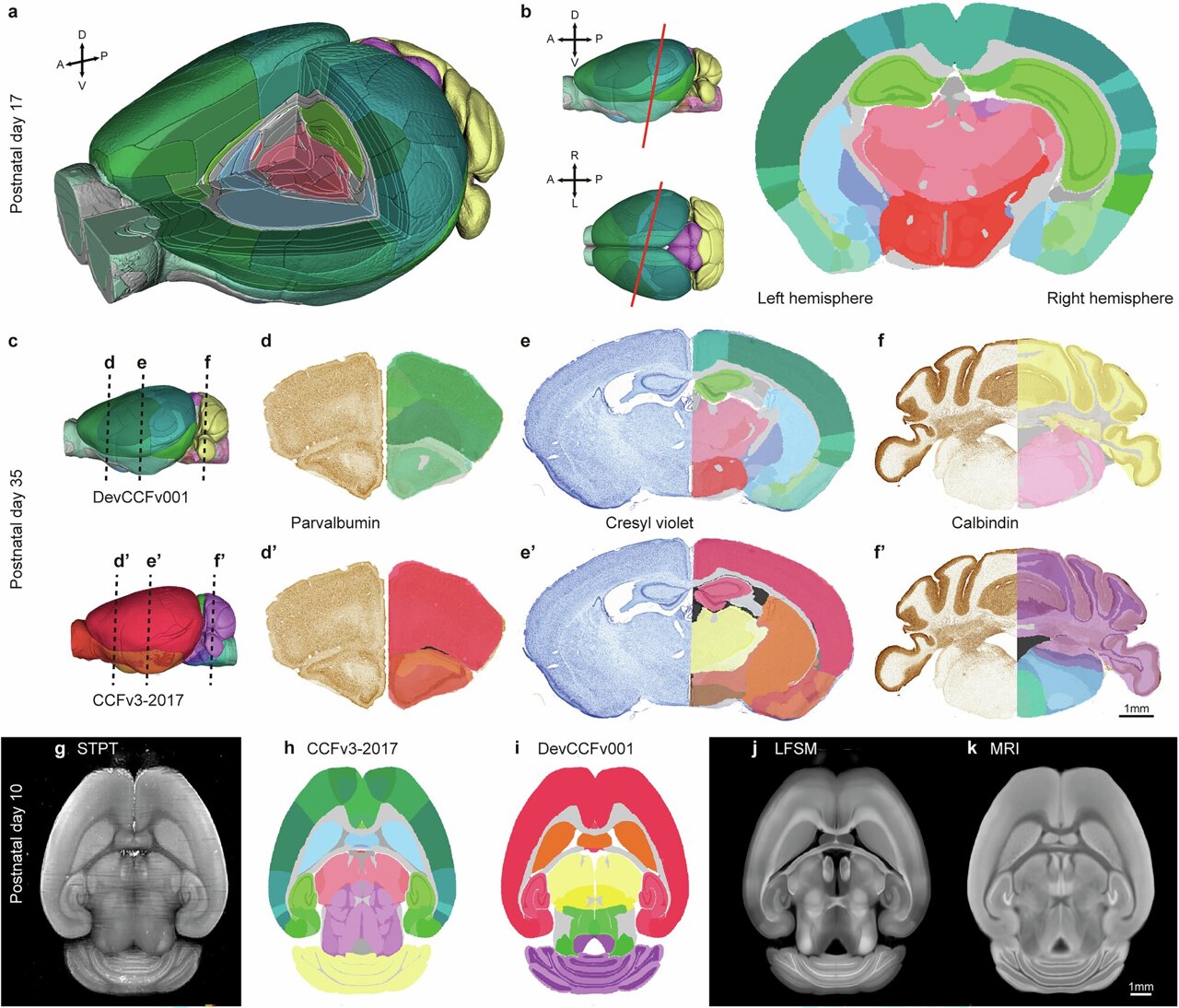 A 'Google Earth' for the brain: What a 4D atlas reveals about growth