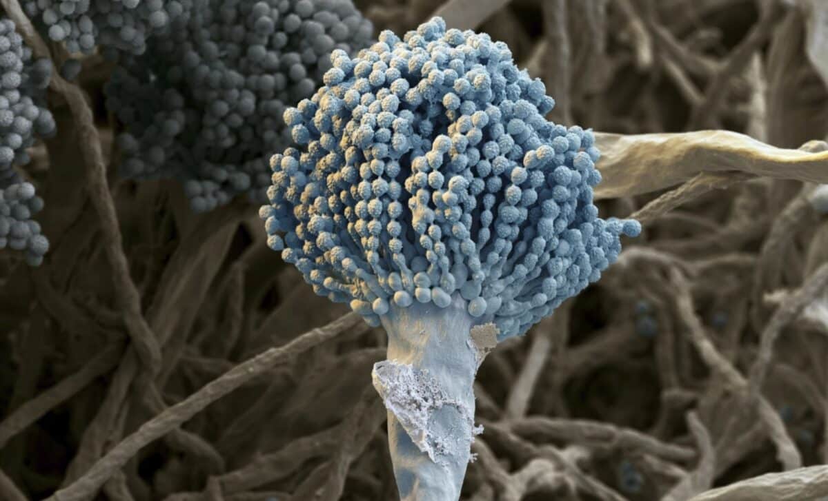 A deadly fungus that eats human body from within is spreading rapidly ...